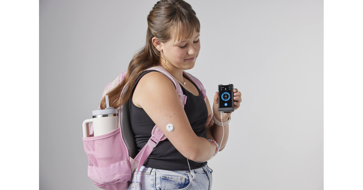 Beta Bionics Announces Launch of the iLet Bionic Pancreas With Abbott’s ...