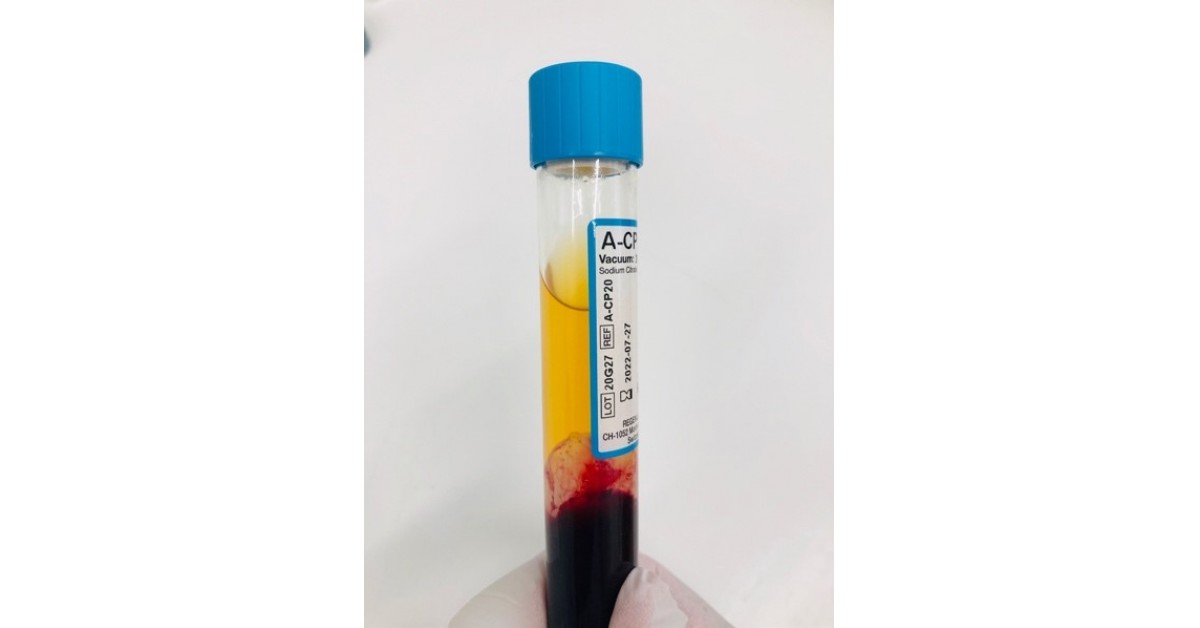 Acellular-Convalescent Plasma (A-CP) and New Technologies Introduced by ...