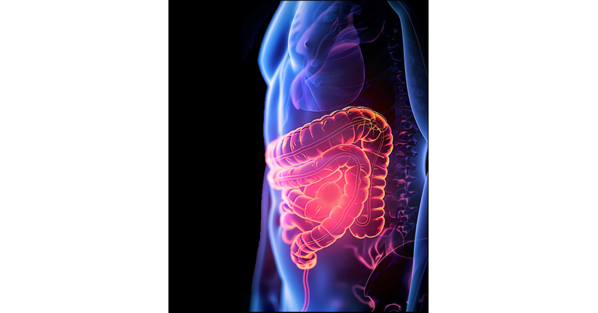 Following Positive Phase 2 Results and Orphan Drug Designation, Biodexa ...