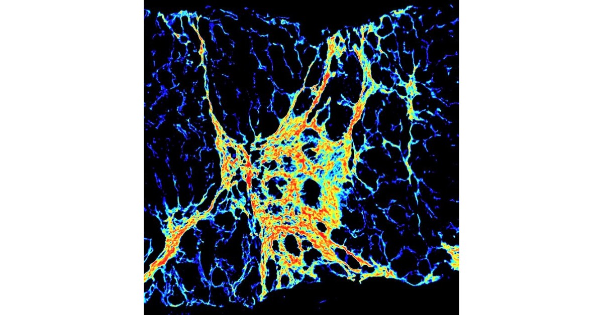PharmaNest Launches FibroNest, the First Multivendor Image Analysis and ...