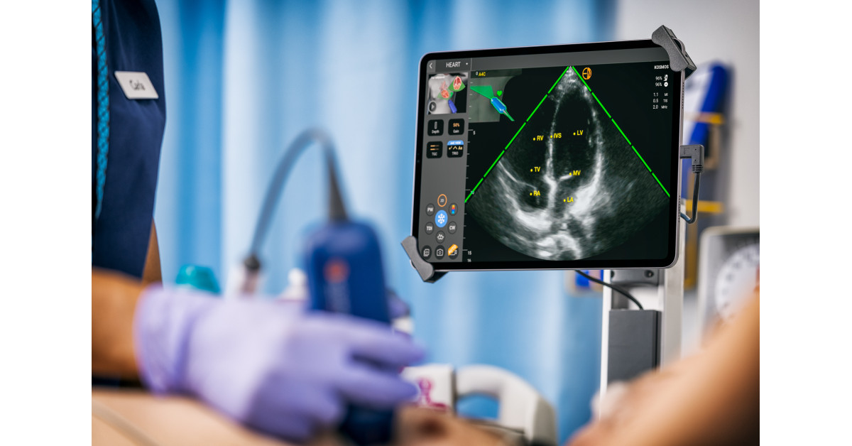 EchoNous Unveils Kosmos Plus: Giving Hospitals a Low-Cost Alternative ...