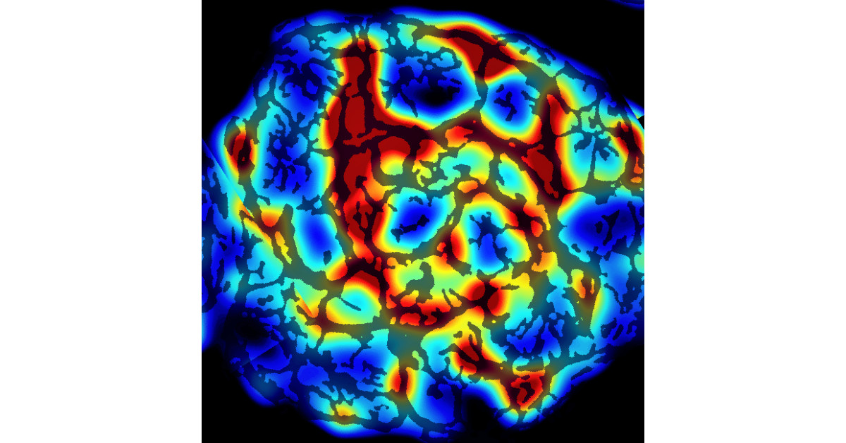 Novel Phenomics NASH In Vitro Assay Presented by InSphero AG and ...