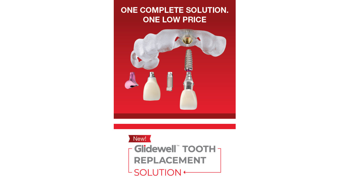 Glidewell Launches Glidewell(TM) Tooth Replacement Solution for Implant Treatment | Newswire