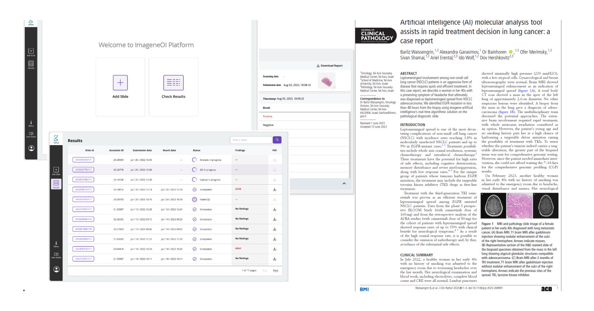 Imagene Launches ImageneOI Platform on Oracle Cloud Infrastructure to ...