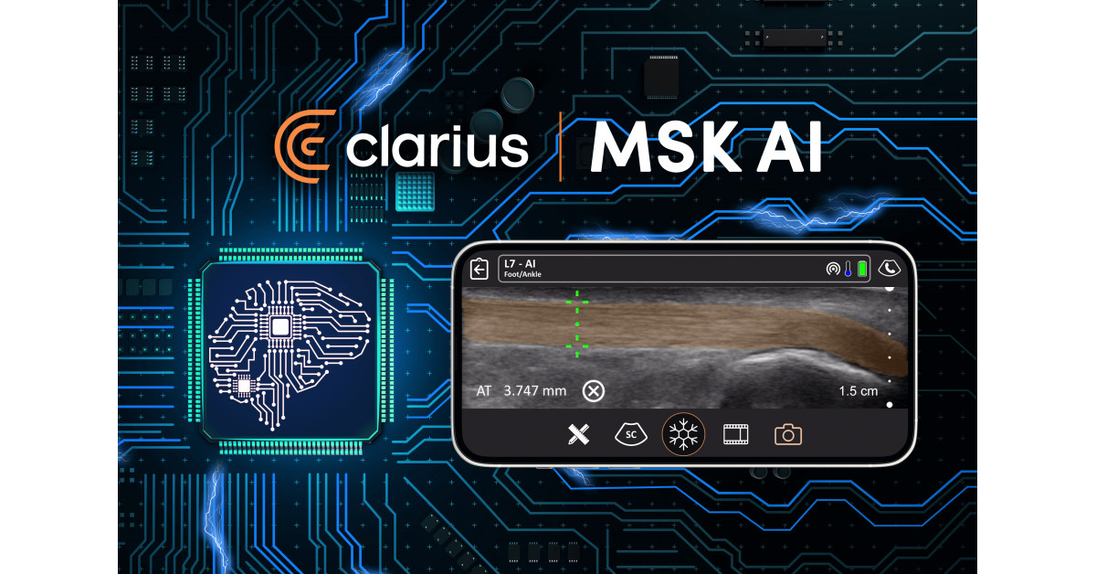 Clarius Announces the First FDA-Cleared AI Ultrasound Application for ...