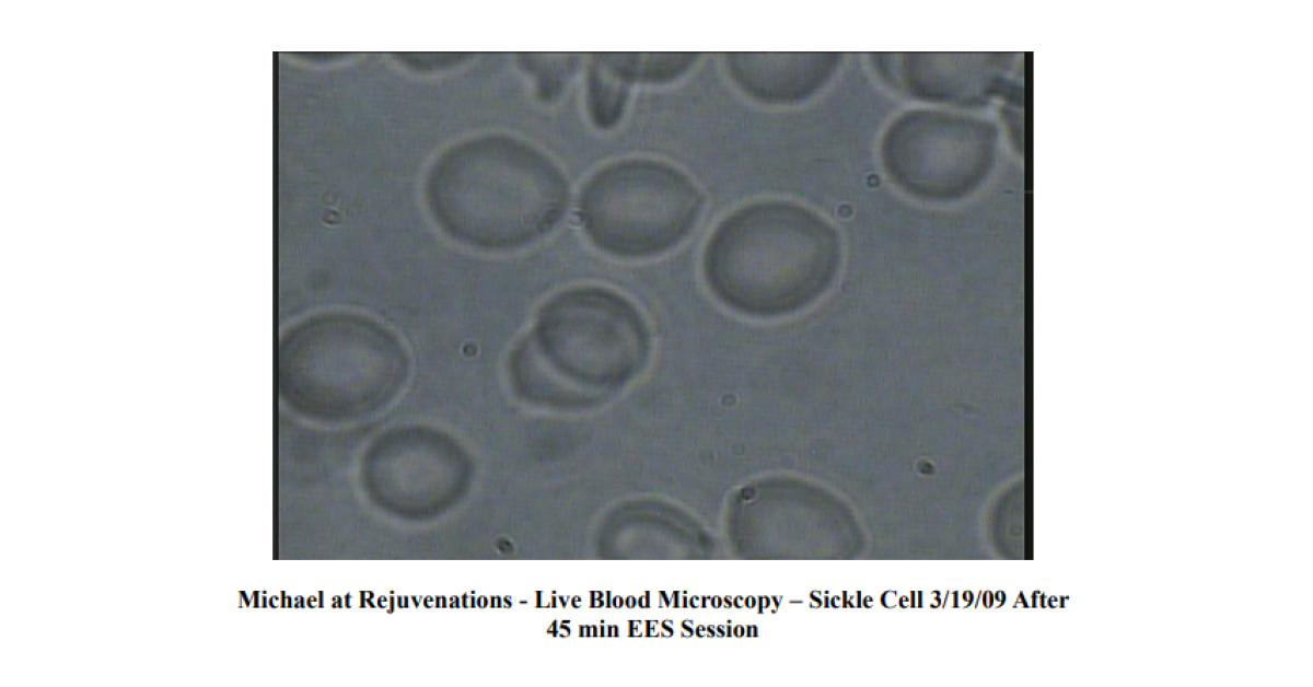 Rejuvenations Releases Preliminary Dark-Field Live Blood Microscopy ...