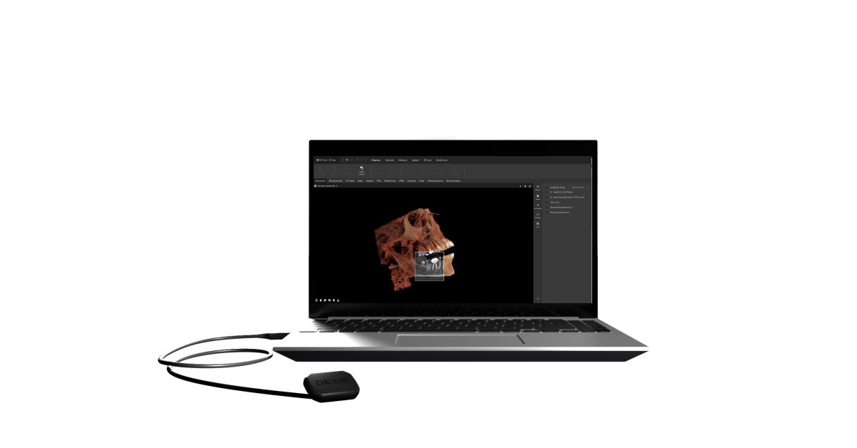 DEXIS Launches DEXIS Connect Pro, a New Proactive Service Platform for ...