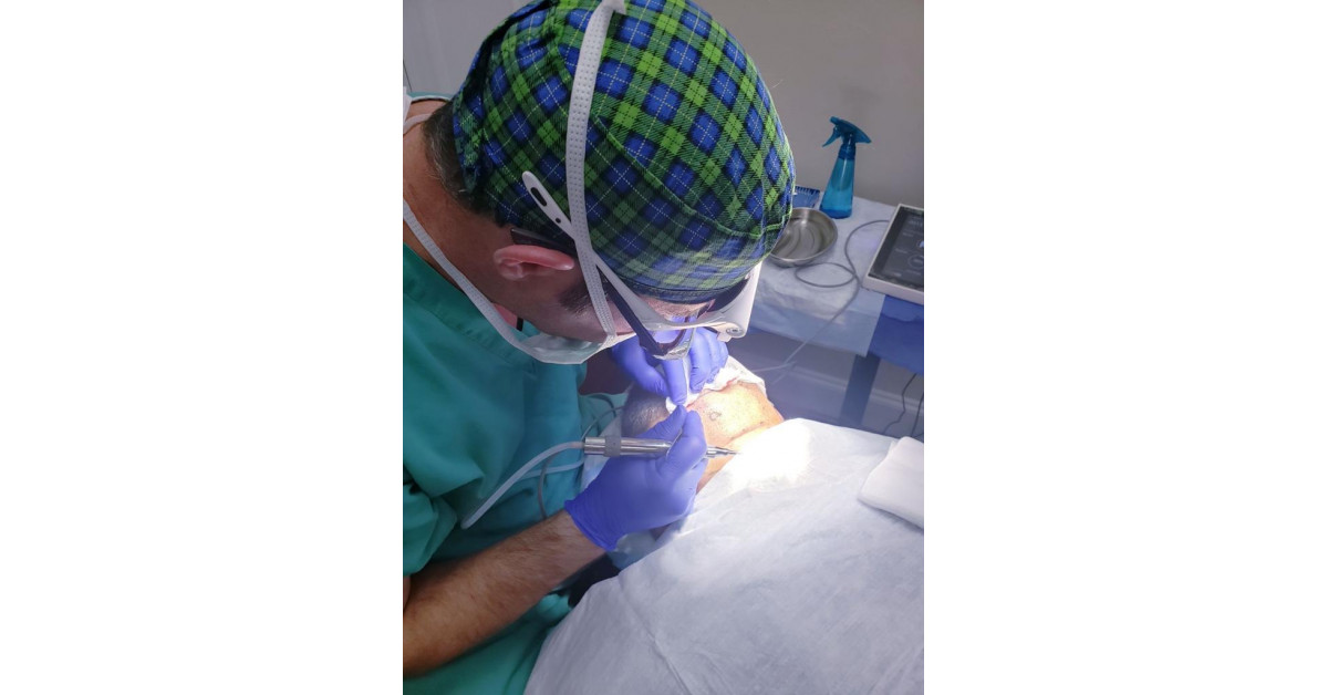 Dr. Jesse Smith Purchases Trivellini Hair Transplant Tech | Newswire