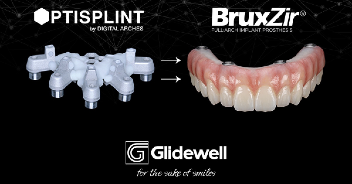 Glidewell Partners With Digital Arches to Streamline All-on-X Workflows ...