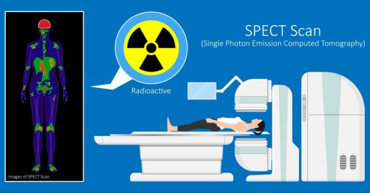 Global SPECT and SPECT-CT Market to Obtain Over US $1.90 Billion by ...