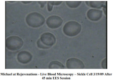 Rejuvenations Releases Preliminary Dark-Field Live Blood Microscopy ...