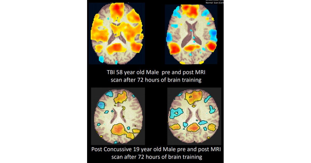 LearningRx Brain Training Reviews the Benefits of Cognitive Baselines ...