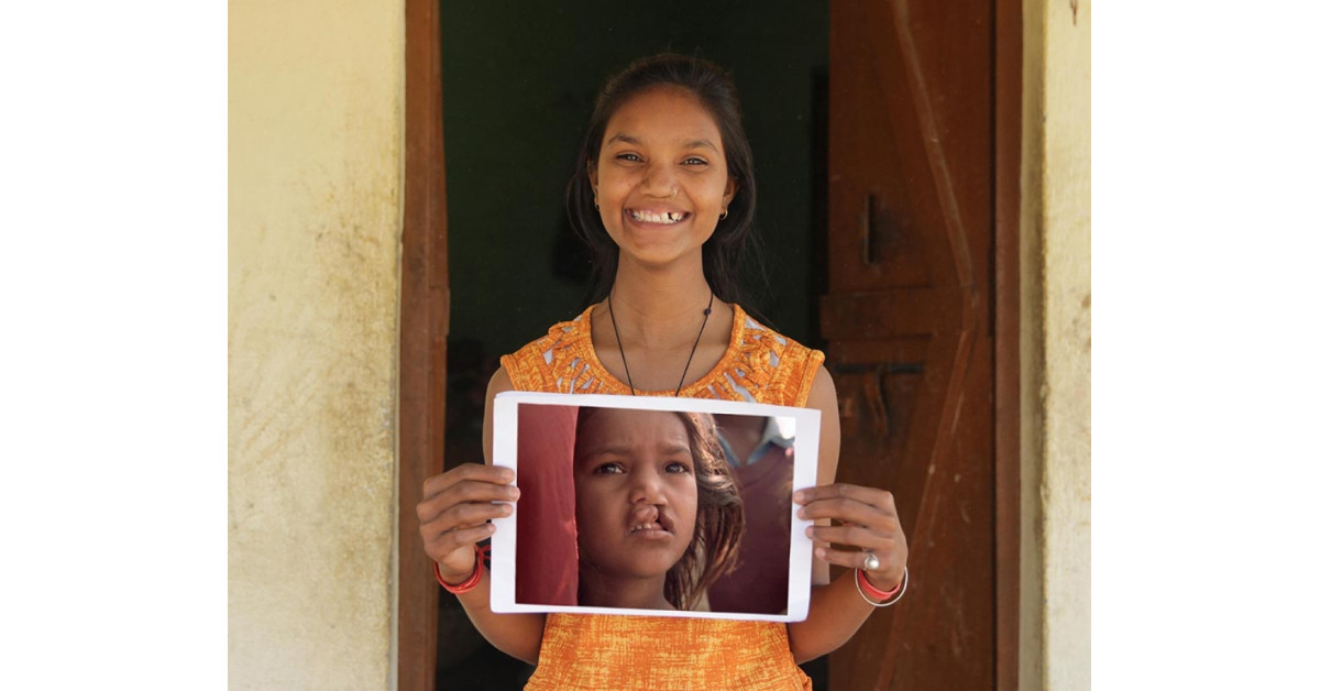 Vincent Amodio Launches SnapCrack Franchise: Revolutionizing Wellness ...