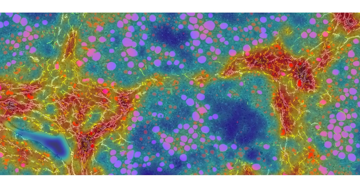 PharmaNest to Present Six Digital Pathology Abstracts at the ...